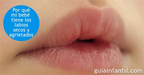 Labios secos y agrietados en bebés Tratar sequedad en el recién nacido