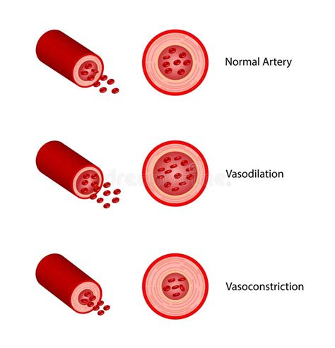 Vasodilatación Normal Y Vasoconstricción De La Línea De Color De Los