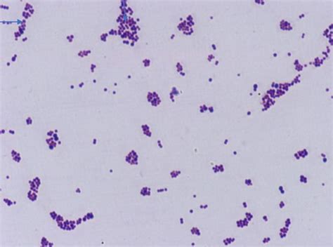 Infectious Bacteria Fungi Yeast Morphology Flashcards Quizlet
