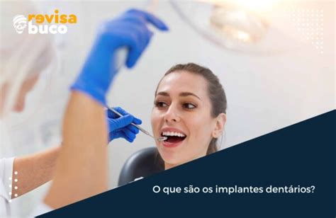 Implantes Dent Rios O Que S O E Quais As Suas Indica Es Revisa