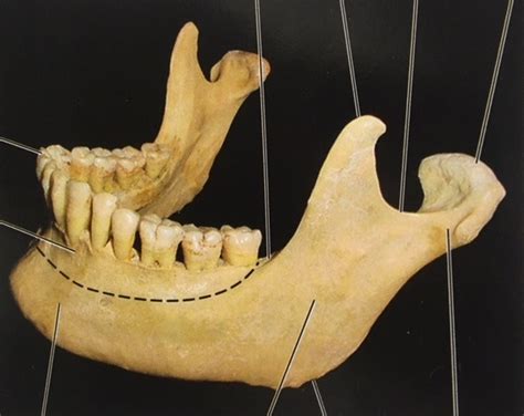 Landmarks Of The Mandible Diagram Quizlet