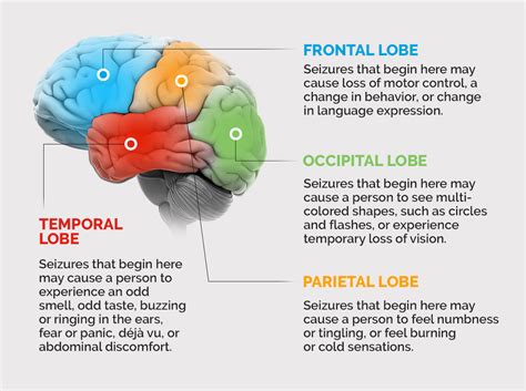 Epilepsy Brain Diagram