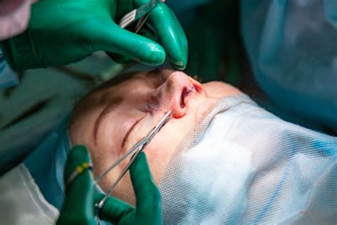 Exploring The Benefits Of Balloon Sinuplasty Dr Rao S ENT Super