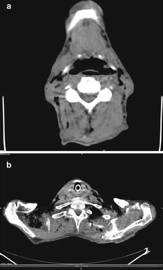 Head And Neck Radiology Key