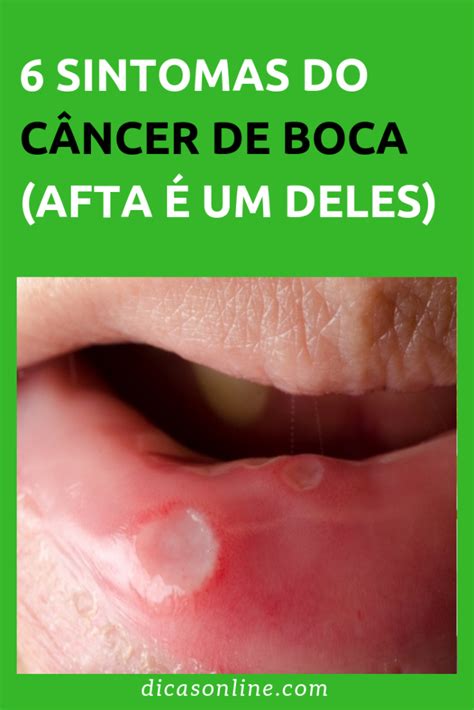 6 Sintomas do câncer de boca
