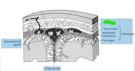 Cross Sectional Anatomy Chapter 3 Brain Flashcards Quizlet