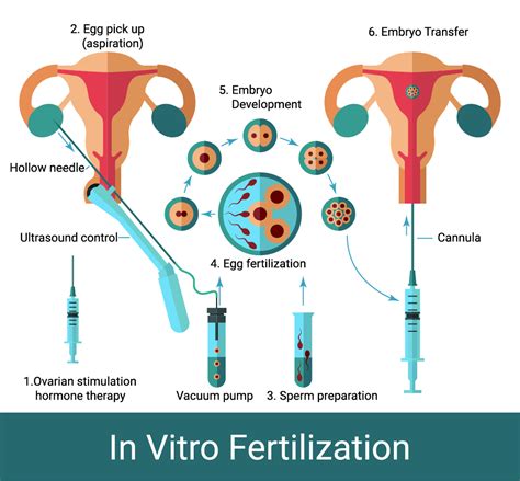 IVF Everything You Need To Know About IVF The Moms Blog