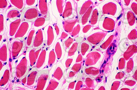 Mammal Skeletal Muscle Transverse Section 500X Skeletal Muscle