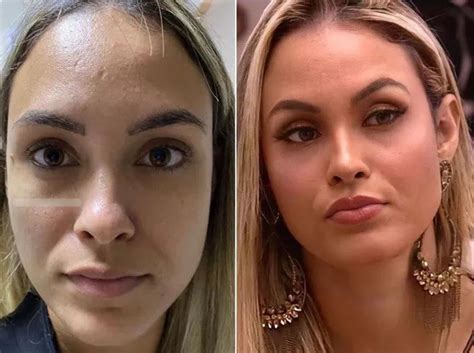 Sarah do BBB 21 já fez harmonização facial veja antes e depois