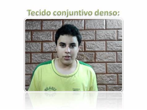 Tecido Conjuntivo Propriamente Dito YouTube