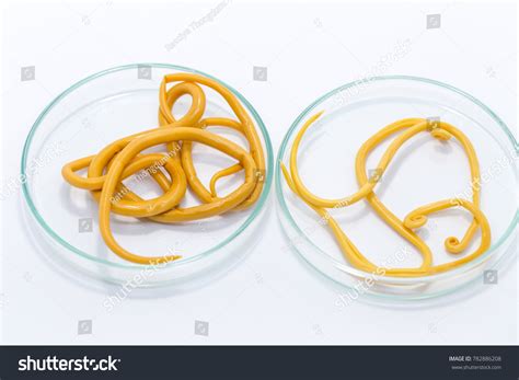 Ascariasis Disease Caused By Parasitic Roundworm Stock Photo 782886208