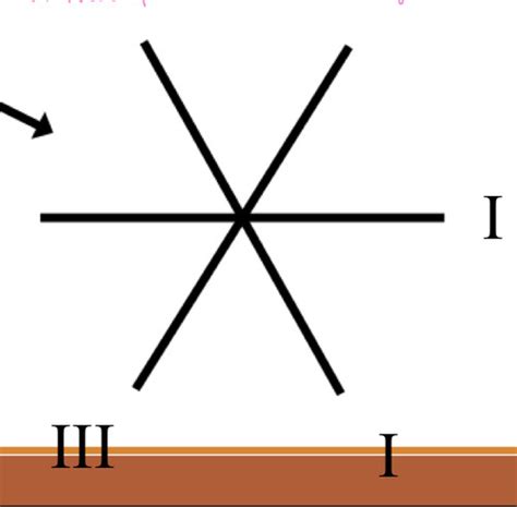 Lead Ekg Flashcards Quizlet