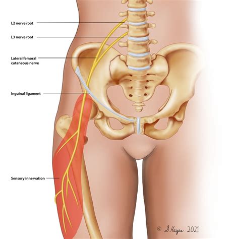 Meralgia Paraesthetica What Is It And How To Stop It Gymless
