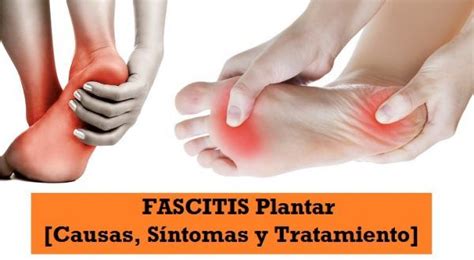 Fascitis Plantar Causas S Ntomas Y Tratamiento Educacion Fisica