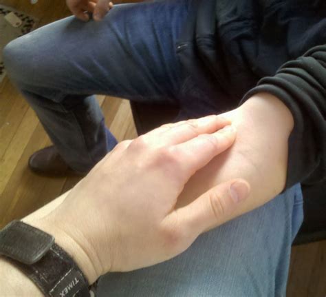 Where Is The Brachial Pulse