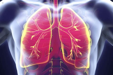 Derrame Pleural qué es síntomas y tratamiento Top Doctors
