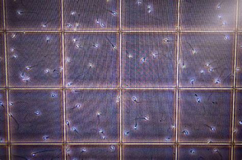Sperm Count Is Declining At Accelerating Rate Worldwide Study