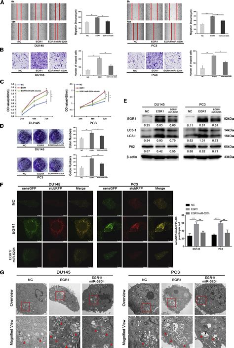 HnRNP L Regulated CircCSPP1 MiR 520h EGR1 Axis Modulates Autophagy And