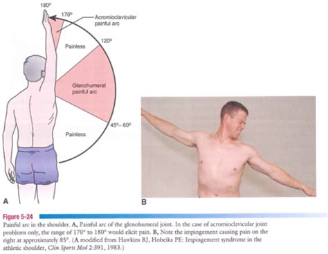 Biomechanics Ch Flashcards Quizlet