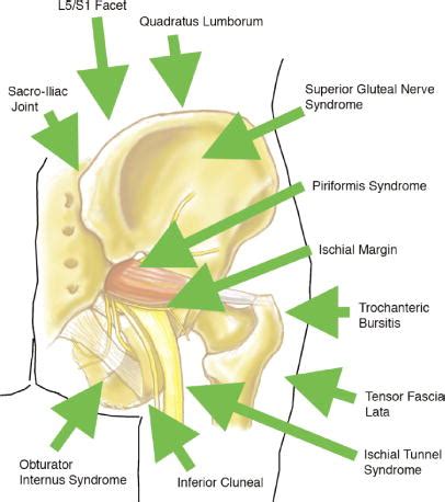 Ischial Spine Pudendal Nerve