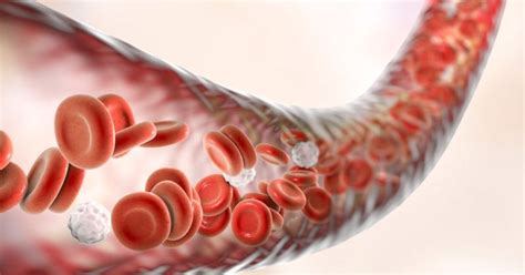 Anemia Przyczyny Objawy I Leczenie