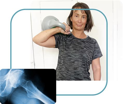 Ruth S Double Hip Replacement Case Study Mr Nirav Shah