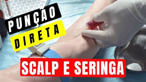 Aula 3 PUNÇÃO VENOSA DIRETA SCALP E SERINGA punção aula