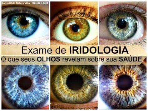 Iridologia o que é e como funciona Guia Digital Anápolis na Net