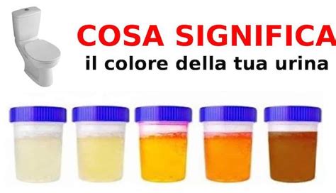 Il Colore Delle Urine Rivela Delle Importanti Informazioni Sul Tuo