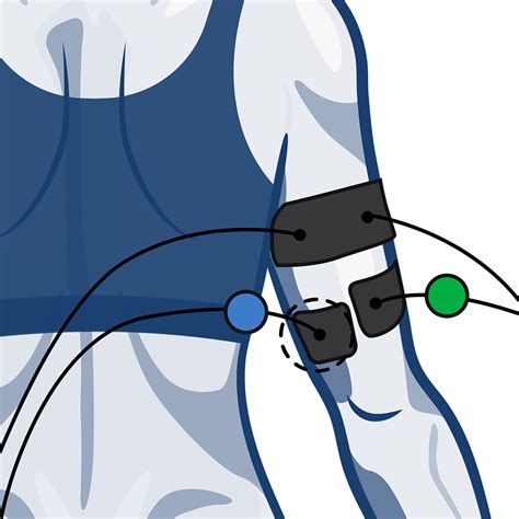 Electrode Placement Compex Australia
