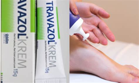 Travazol Krem Nedir Uçuk Için Kullanılır Mı Kadınlar Kulübü