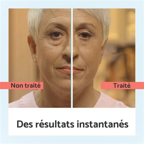 Remescar Poches Cernes Remescar