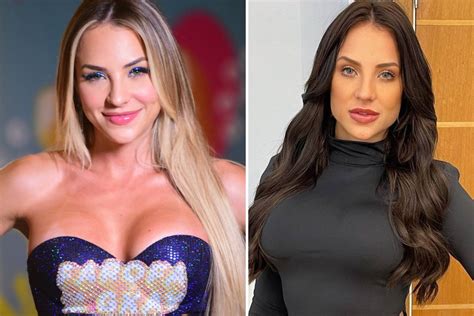 Gabi Martins Celebra Revers O Da Harmoniza O Facial