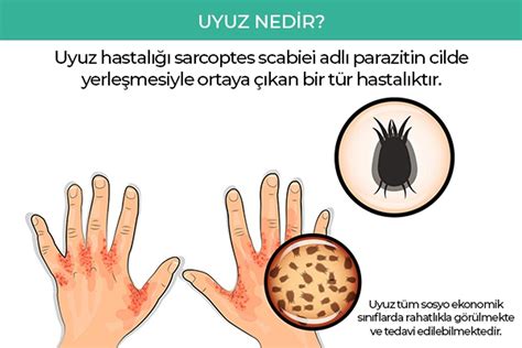 Son G Nlerde Evremizde Ok A Duymaya Ba Lad M Z Uyuz Hastal