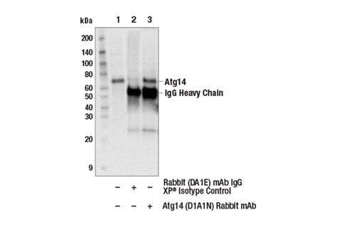 ULK1 Substrate Antibody Sampler Kit Cell Signaling Technology