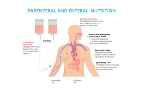What Is Parenteral And Enteral Nutrition CredaHealth