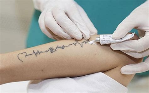 Cập nhật hơn 79 về thuốc xóa hình xăm coedo vn