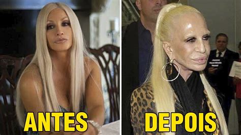 As cirurgias PLÁSTICAS que deram muito errado YouTube