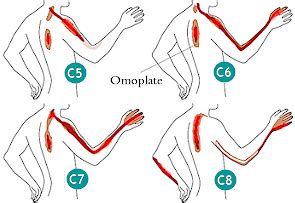 Comprendre Et Soulager Sa N Vralgie Cervico Brachiale En Exercices