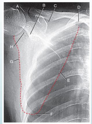 Scapula Xray Diagram Quizlet