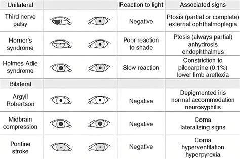 Free Printable Pupil Size Charts Pdf Actual Size Mm Scale