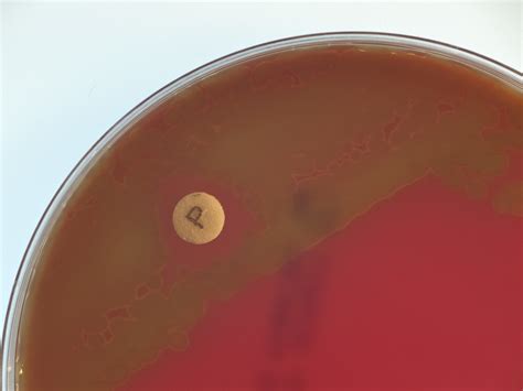 Hemólisis Alfa En Agar Sangre