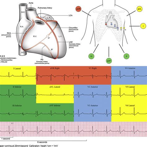 Diagram Of 12 Lead ECG Quizlet