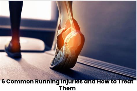 The 6 Common Running Injuries And How To Treat Them The Ace Fitness