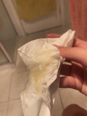 Does This Look Like My Mucus Plug Babycenter