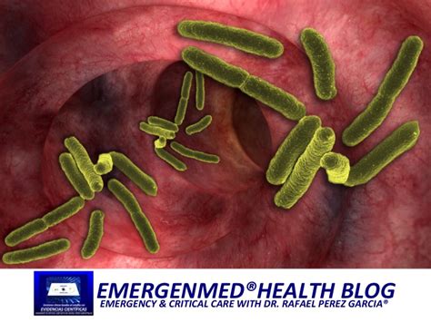 EmergenMed Health Blog Sobrecrecimiento Bacteriano Del Intestino