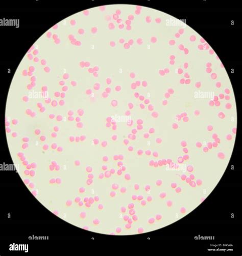 Bacterial Cells Under Microscope 400x