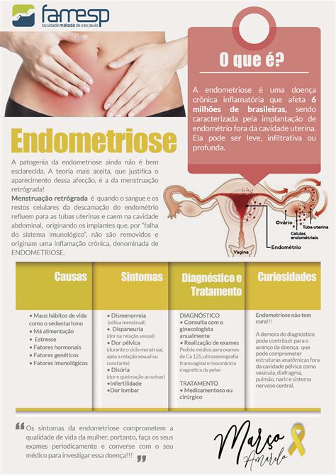 Endometriose Qu est ce que l endométriose AP HM Learn about