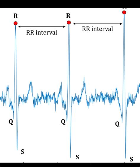 1 decomposition of heartbeats into qrs complexes the ecg signal was download scientific