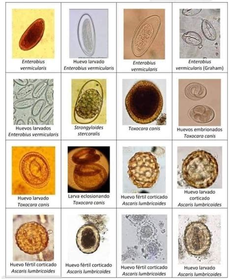 Pin De Boonchawee En Stool Parasite Examenes De Laboratorio Medicina
